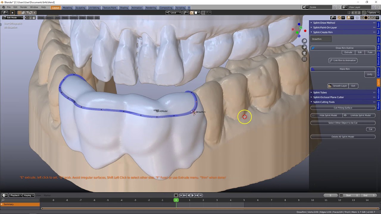 B4D Splint - YouTube