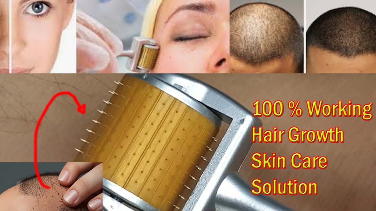 Derma Roller hair growth results or skin Derma roller system for Hair ...