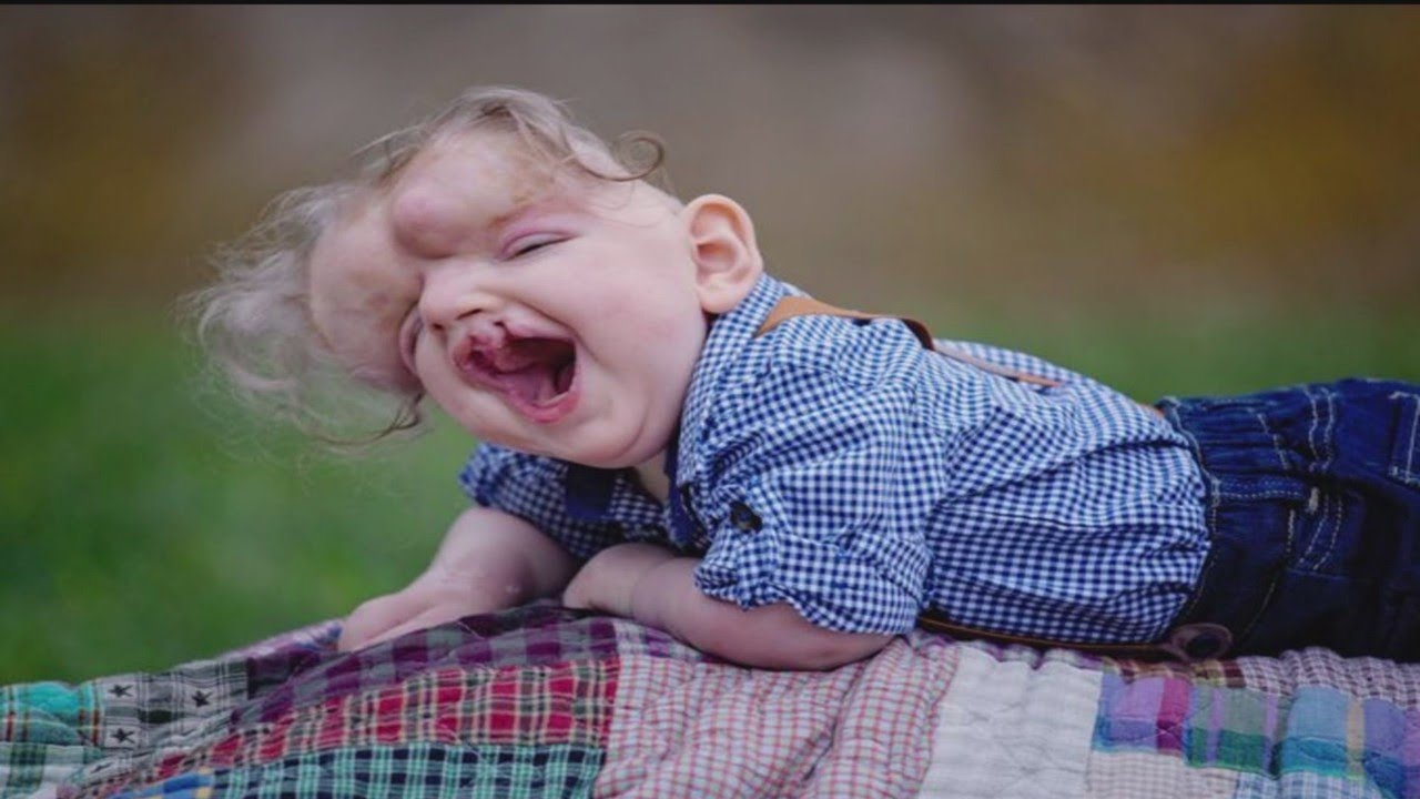 'I love him the way he is' - Springfield family shares joy of having ...