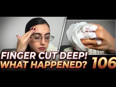 Today in another episode of… What happened to Zeudi? 😳