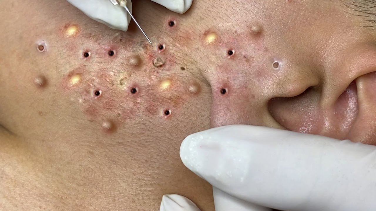 𝐑𝐞𝐟𝐫𝐞𝐬𝐡 𝐘𝐨𝐮𝐫 𝐅𝐚𝐜𝐞 𝐖𝐢𝐭𝐡 𝐒𝐤𝐢𝐧 𝐂𝐚𝐫𝐞 #𝟓𝟑𝟔𝟎74 - YouTube