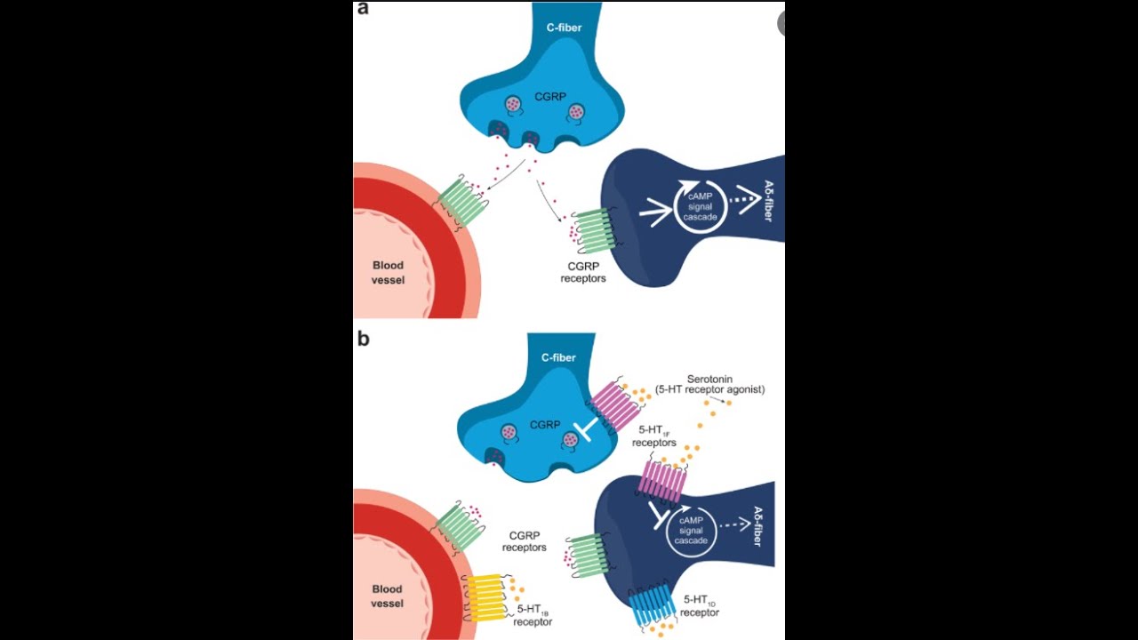 CGRP Inhibitors and Migraine - YouTube