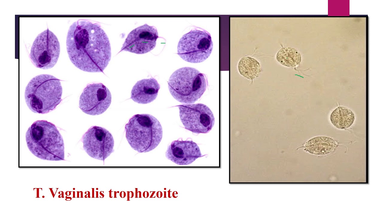 Practical Trichomonas - YouTube