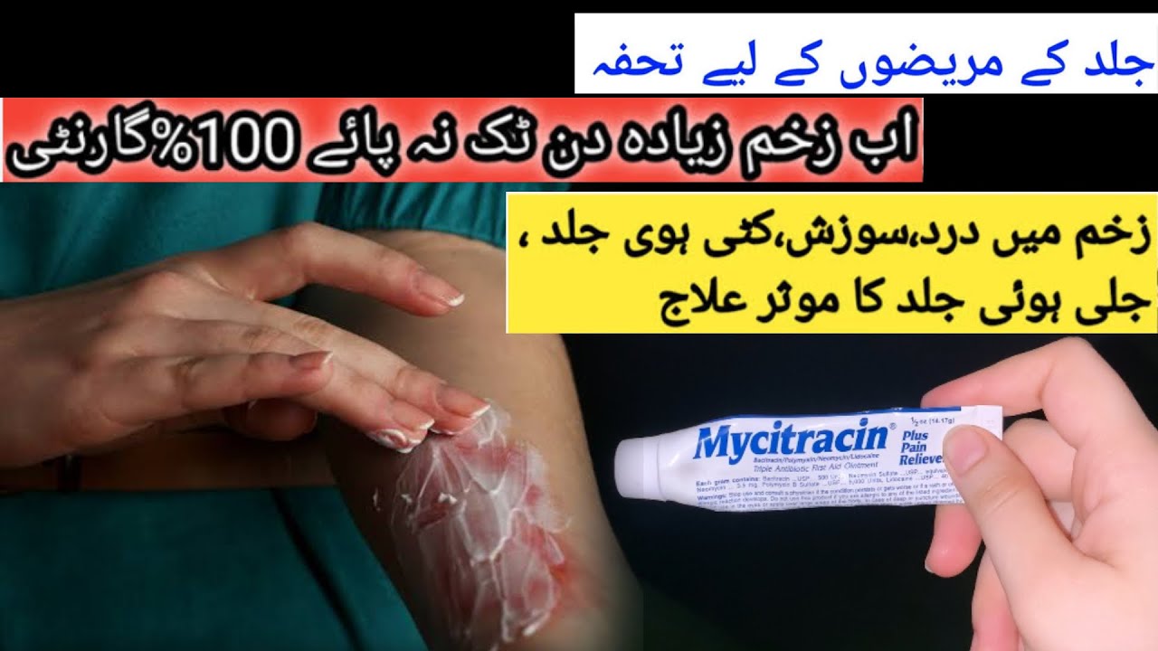 Mycitracin Ointment | A Triple Antibiotic Cream | Benefits or Uses ...