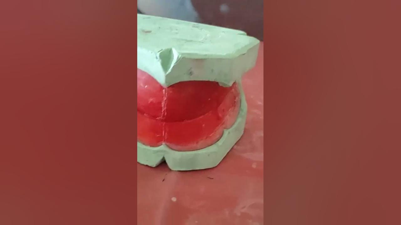 TEETH ARRANGEMENT ON ARTICULATOR MEAN VALUE ARTICULATOR teeth-arrangement-on-articulator-mean-value-articulator