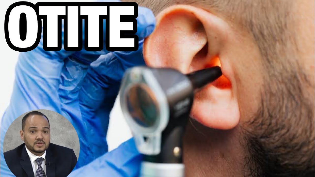 OTITE: Saiba as causas e como evitar essas doenças - YouTube