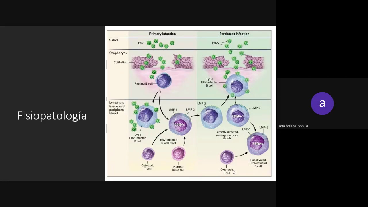 Mononucleosis Infecciosa - YouTube