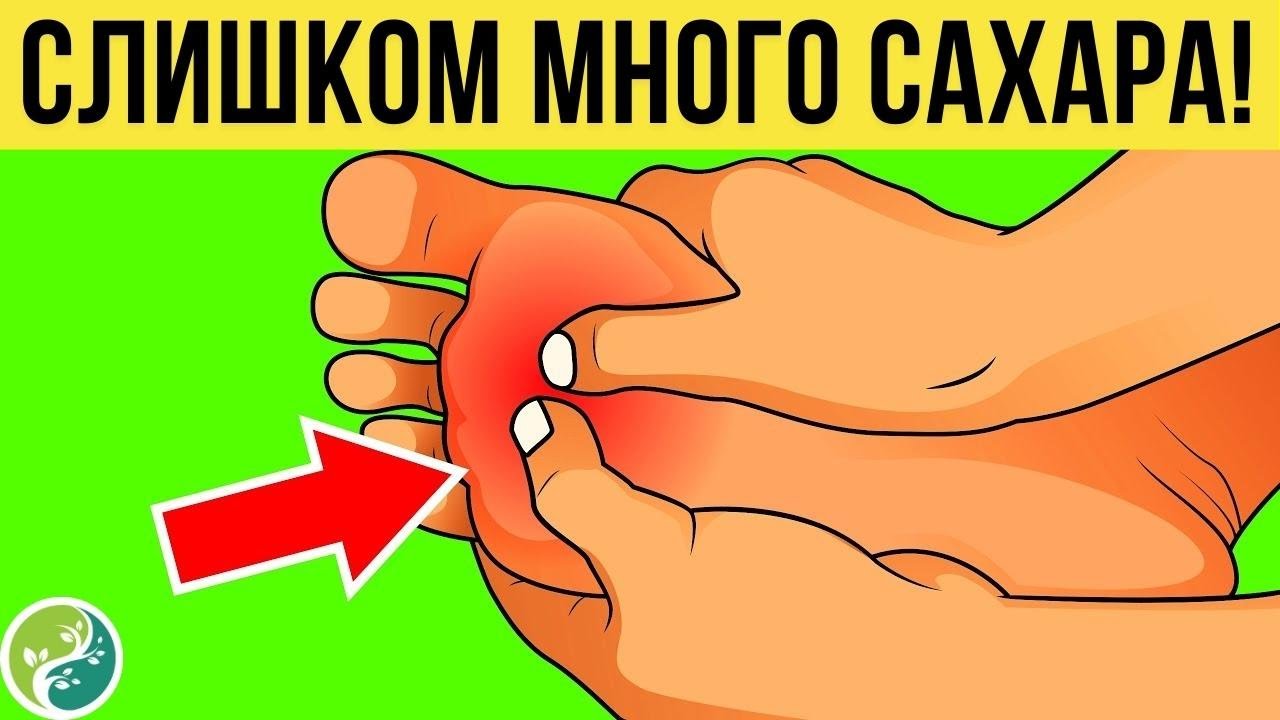 8 Предупреждающих Признаков Того Что Вы Едите Слишком Много Сахара Youtube
