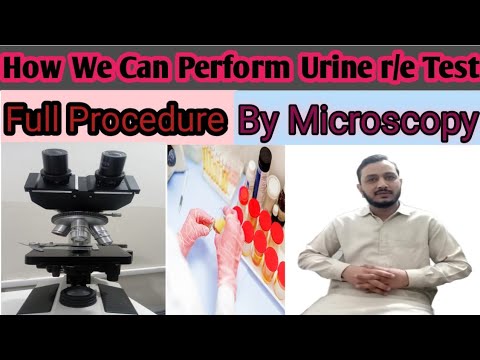 How we can perform urine r/e test by microscopy - YouTube