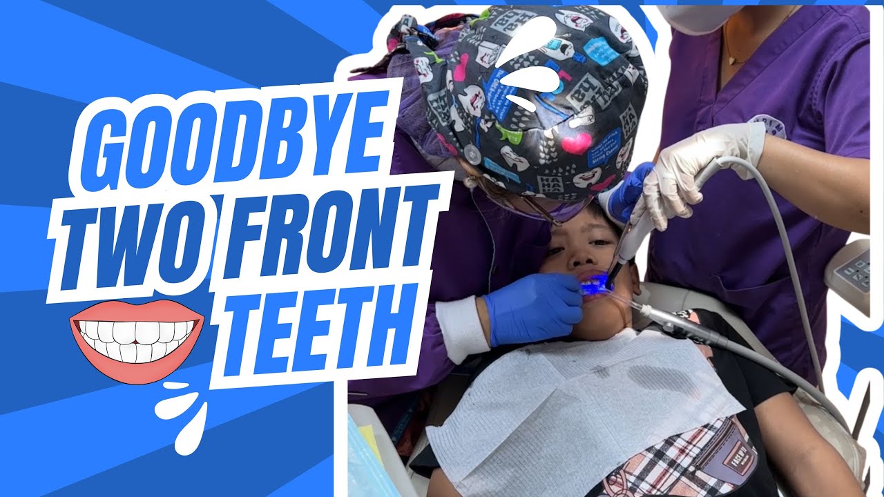 Bye Bye Front Teeth - YouTube