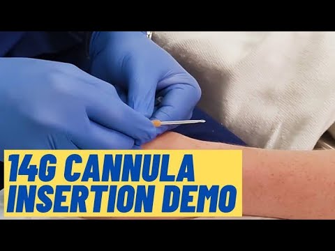 14G Cannula Insertion Demo Step by Step! - YouTube