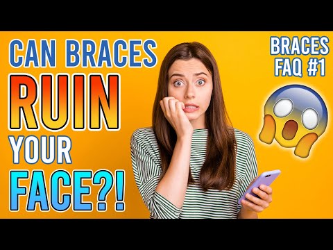 Can Braces Ruin Your Face