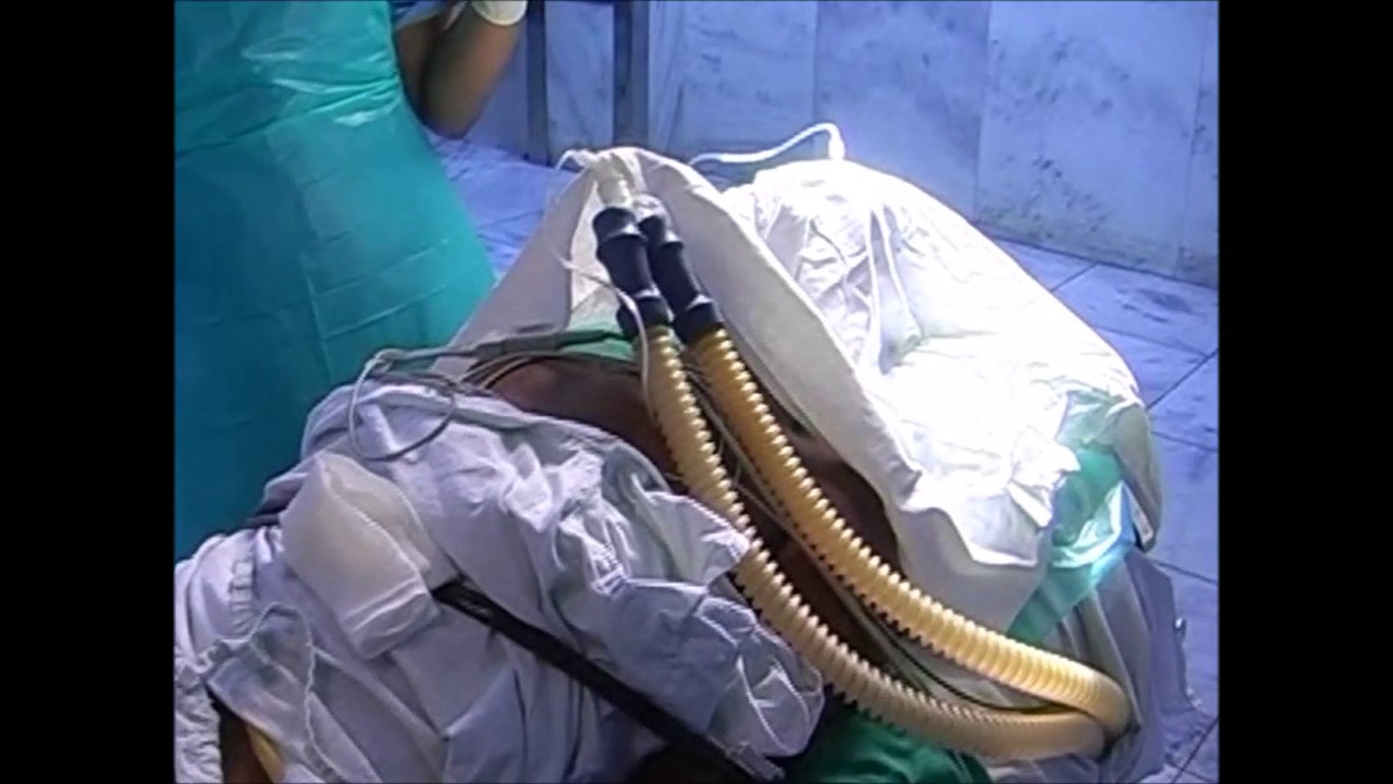 Intracranial Pressure Monitoring with Ventricular Catheter - YouTube