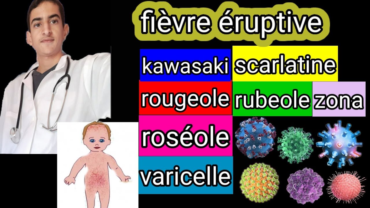la fièvre éruptive - YouTube