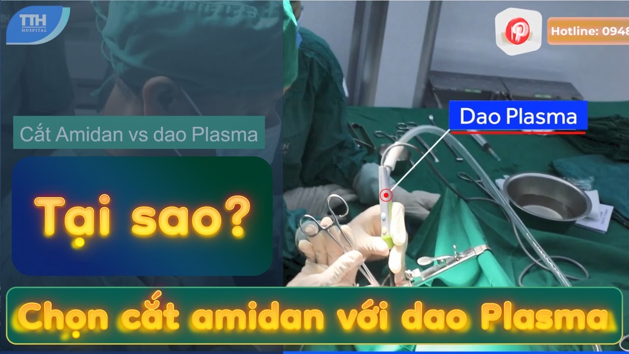 Tại sao nên cắt Amidan bằng dao Plasma thay vì dao điện? - YouTube
