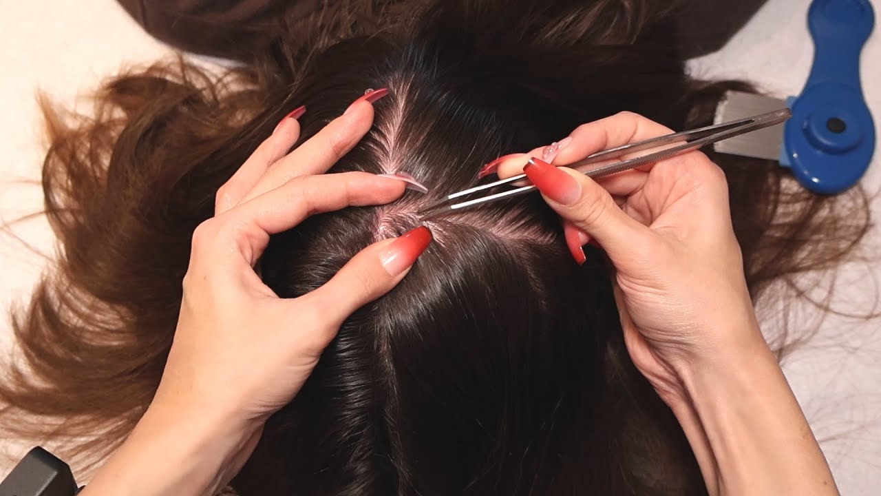 ASMR School Nurse LICE Check on SCALP | Lice Removal with a Comb ...