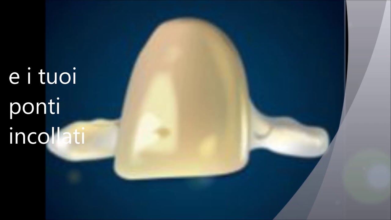 IT Présentation Fast Splint Matrix - YouTube