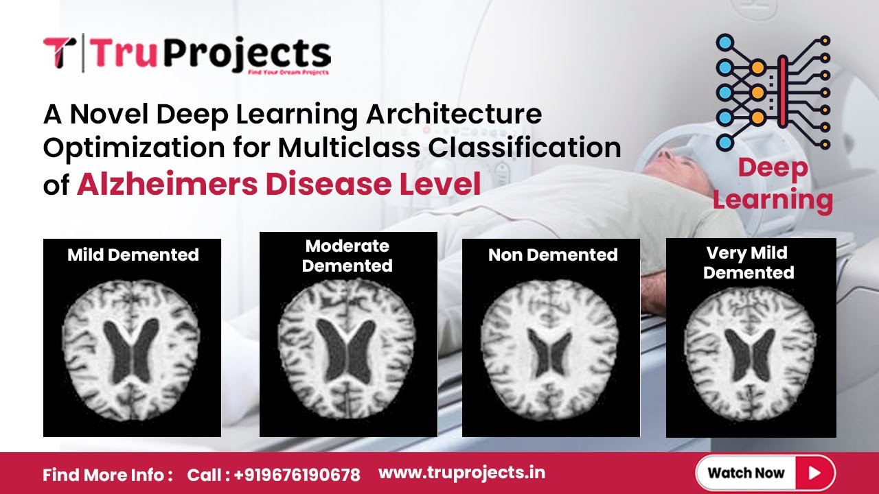 A Novel Deep Learning Architecture Optimization for Multiclass Classification of Alzheimer’s ...
