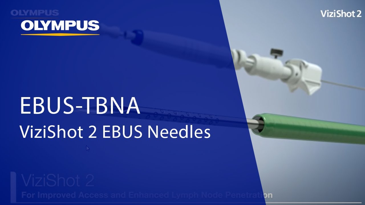 Olympus Extends Portfolio For EBUS-TBNA Medical Design And
