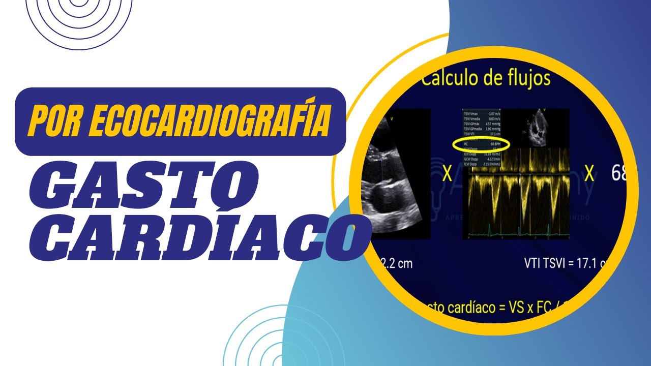 💡💚GASTO CARDÍACO por ECOCARDIOGRAFÍA [Paso a Paso] - YouTube
