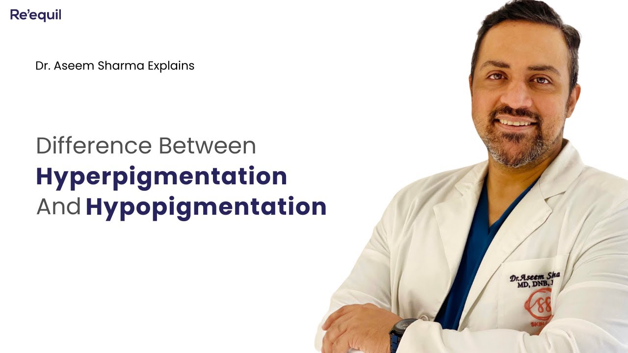 Difference Between Hyperpigmentation And Hypopigmentation - By Dr Aseem Sharma - YouTube