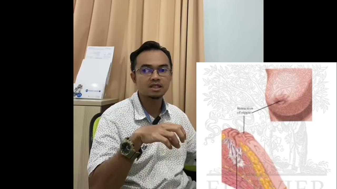 Q&A puting payudara masuk ke dalam - YouTube