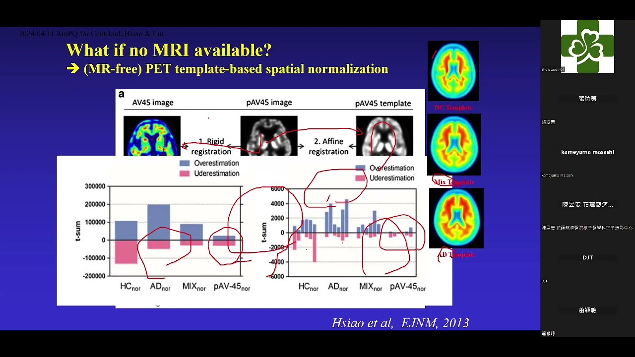 quantitation of amyloid PET with AmPQ (presented by Prof. Ing-Tsung ...