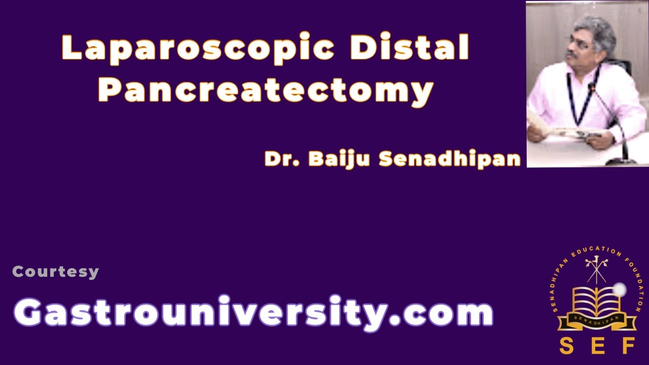 Pancreas-Laparoscopic Distal Pancreatectomy - YouTube