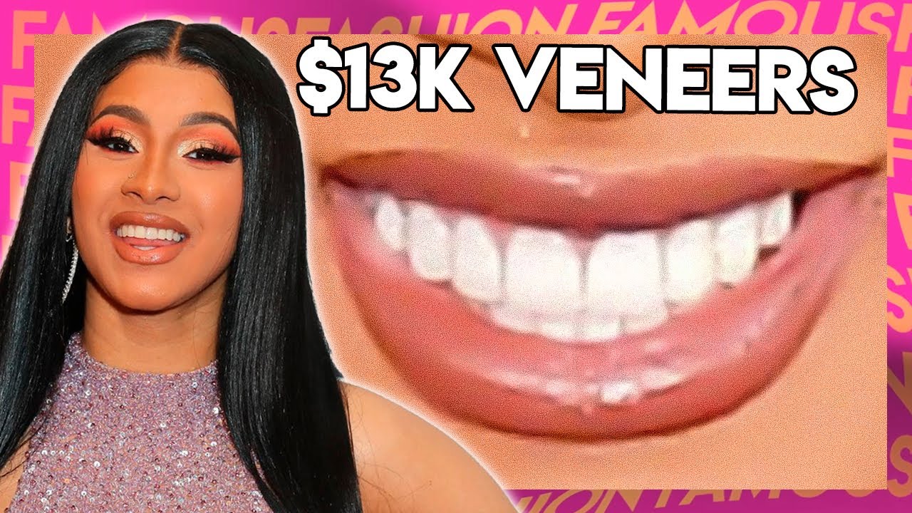 Beyonce Teeth Veneers