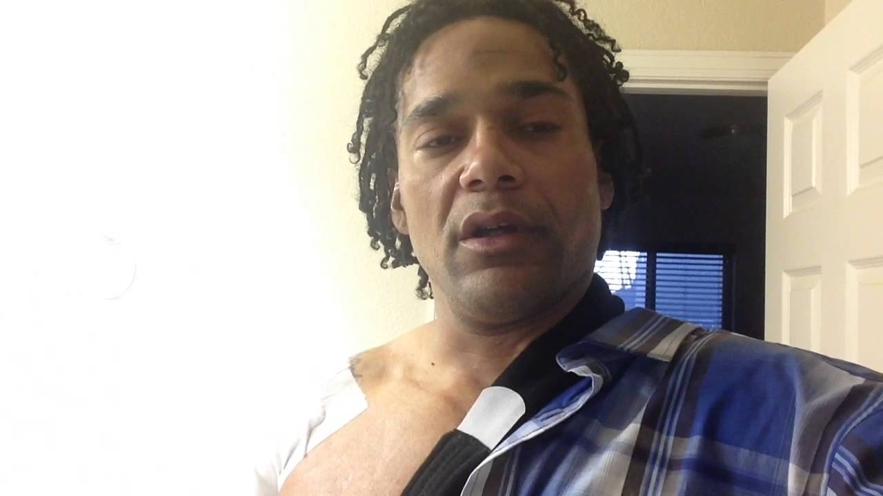 Pec Major Tear Pre and Post Surgery - YouTube