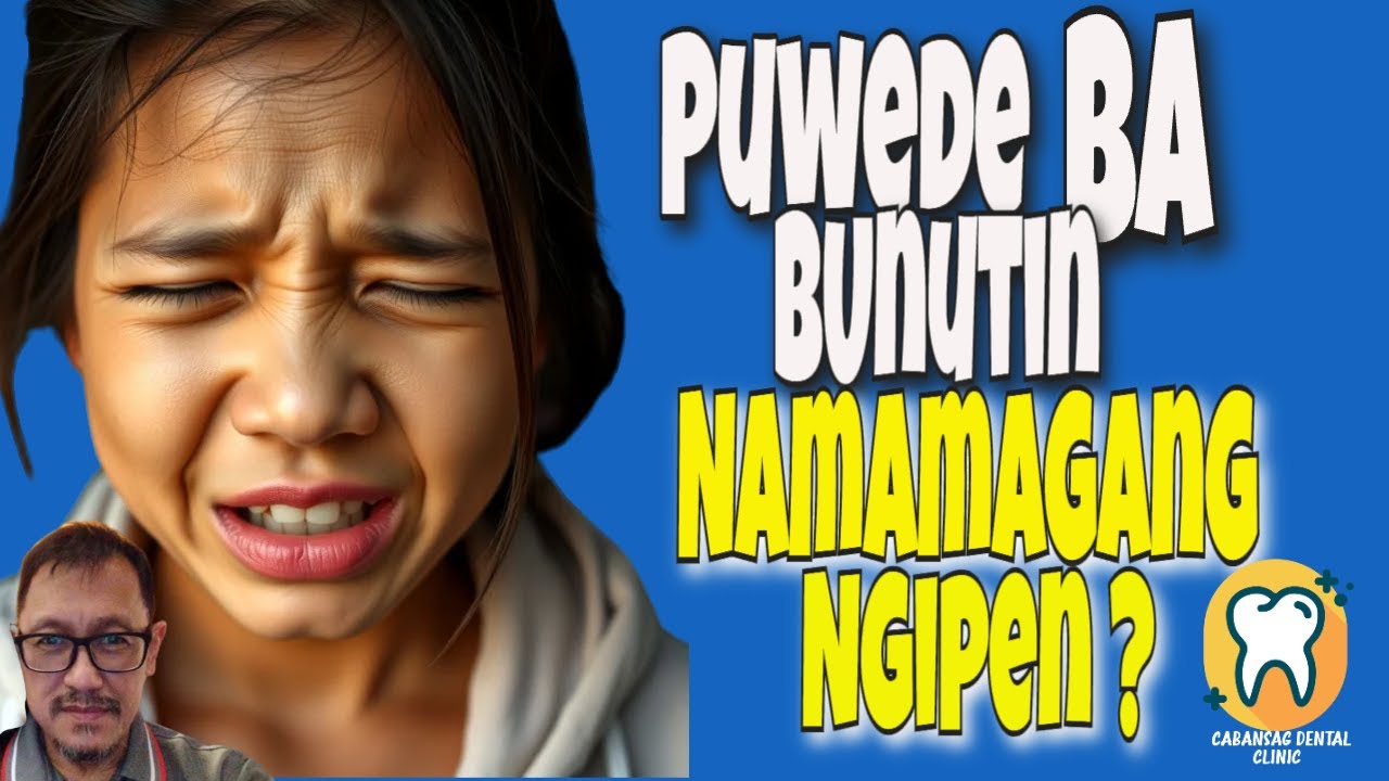 Puwede Ba Bunutin Namamagang Ngipin / wisdom tooth / Gamot - YouTube