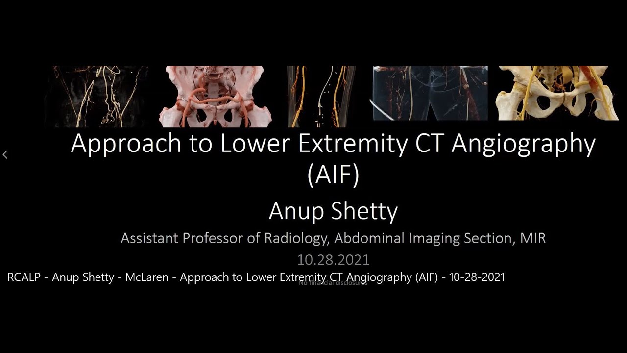 Approach to Lower Extremity CT Angiography (AIF) - YouTube