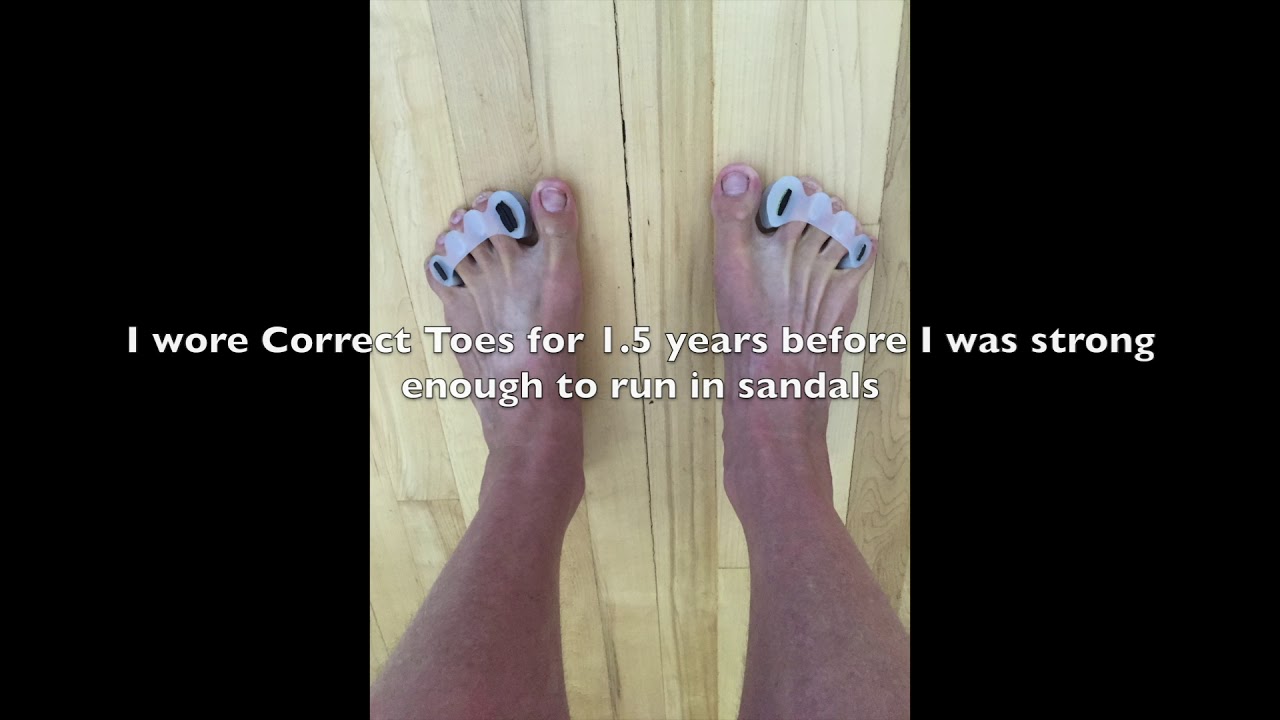 Tyler April 2015, August 2016, August 2017 feet transformation - YouTube