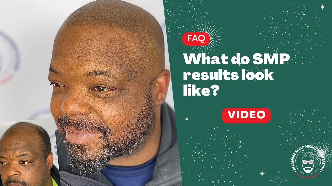 What Do SMP Results Look Like? - YouTube