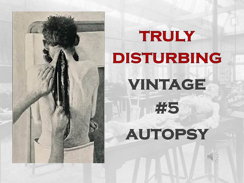 TRULY DISTURBING VINTAGE PHOTOS #5 AUTOPSY REDUX - YouTube