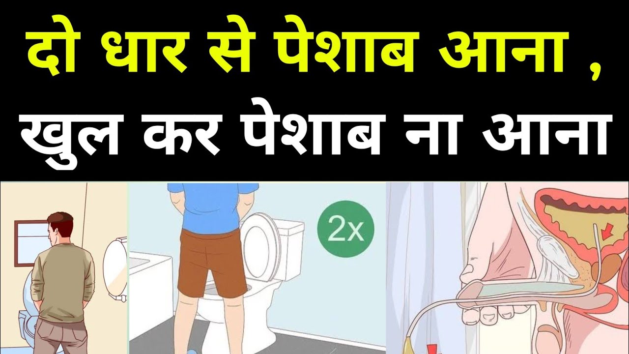 पेशाब की पतली धार और ज़ोर लगाना | peshab me 2 dhaar aana | dr tarun ...