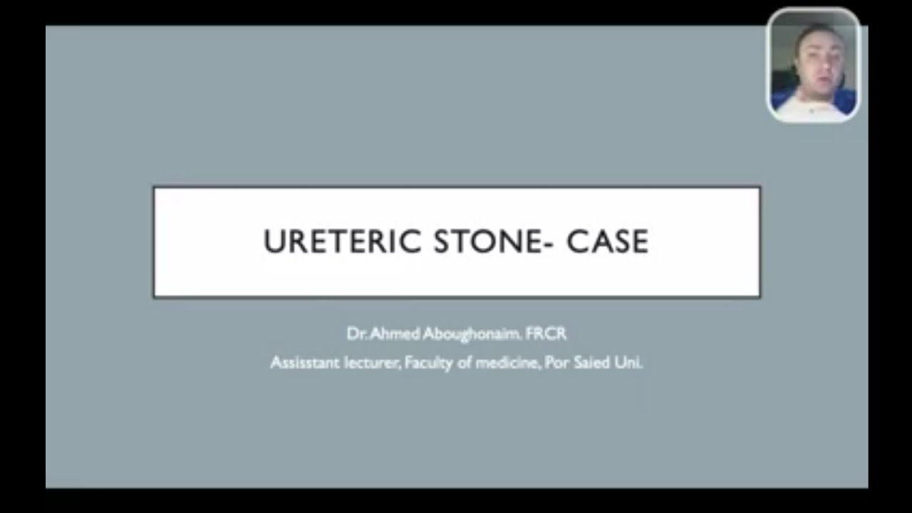 GUT | Ureteric stone | VUJ stone - YouTube