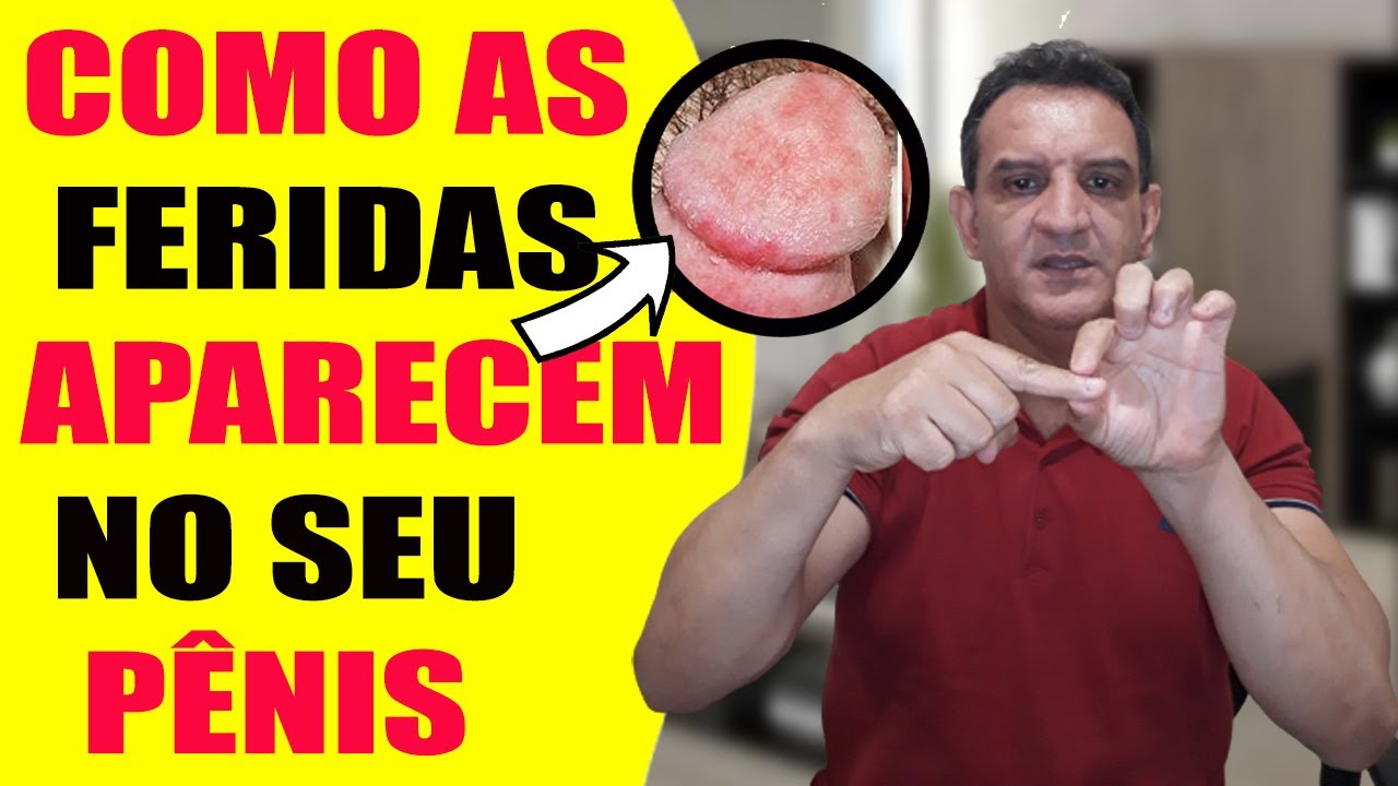 Porque Aparece Machucado No Pênis e o Que Fazer Para Cicatrizar As ...