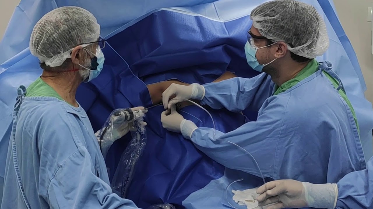 HIPERIDROSE PALMAR - SIMPATECTOMIA TORÁCICA - YouTube