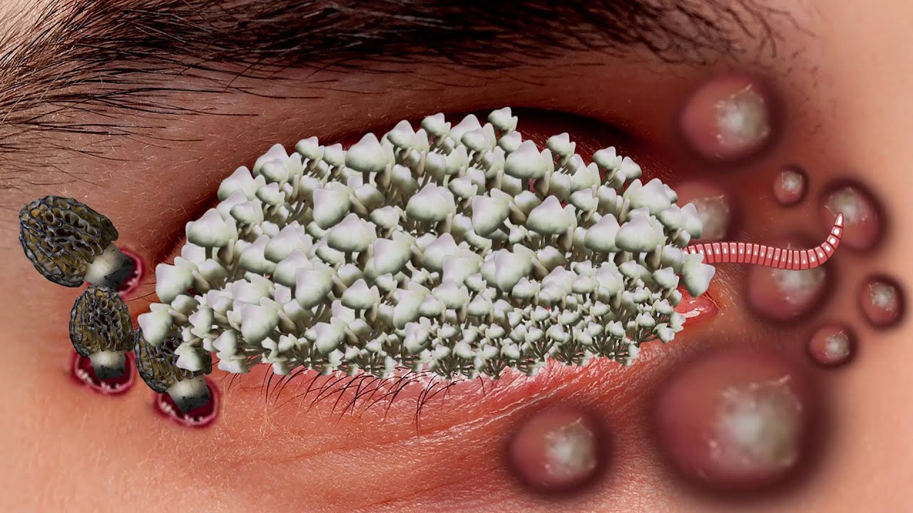 ASMR Eyes treatment | dog tick ASMR | maggot removal | ASMR animation ...