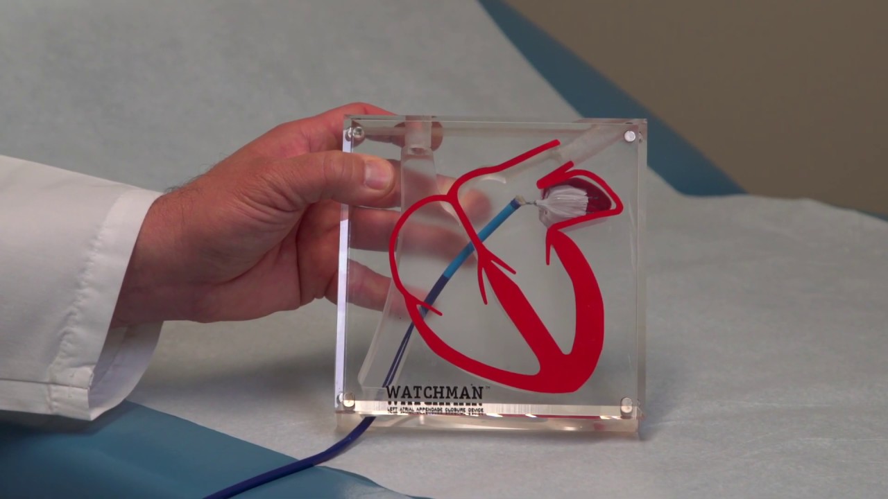 Sansum Clinic Cardiology offers the Watchman Device for Atrial ...