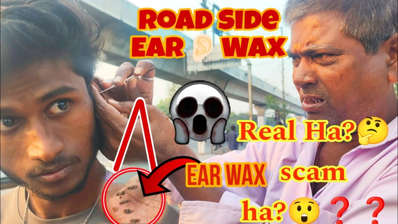 Ear Wax || Road Side Ear Wax 👂🏻 Scam🤔 Or Real 😲 || Indian street Ear ...