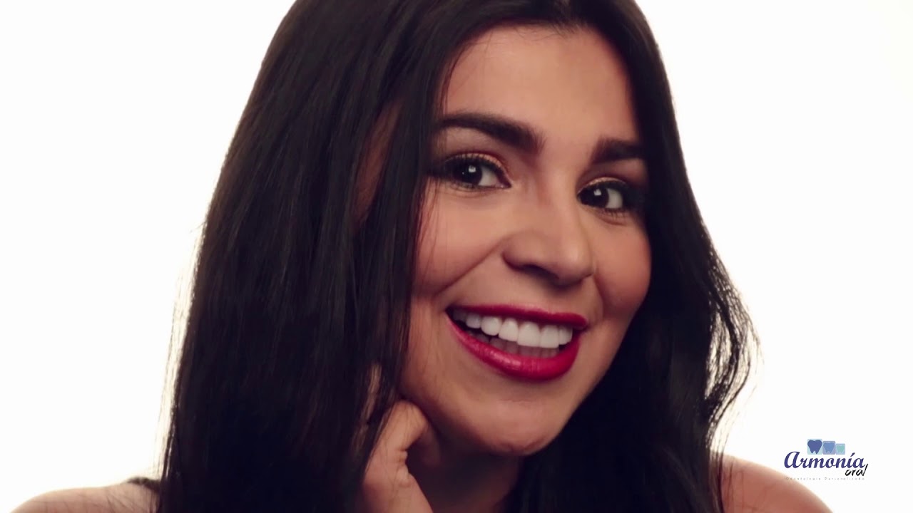 Yolimar Garavito Feliz con su diseño de sonrisa en Armonía Oral - YouTube