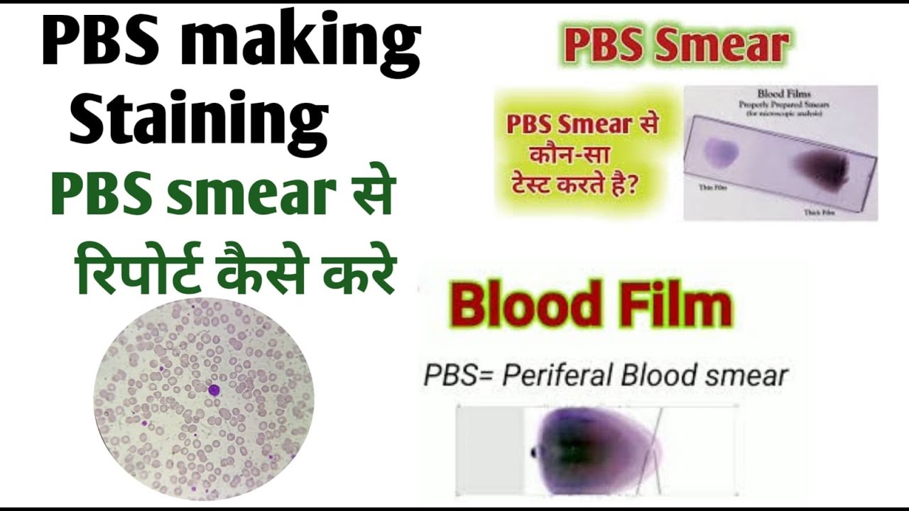 cbc slide making I pbs slide staining procedure I microscope slide ...