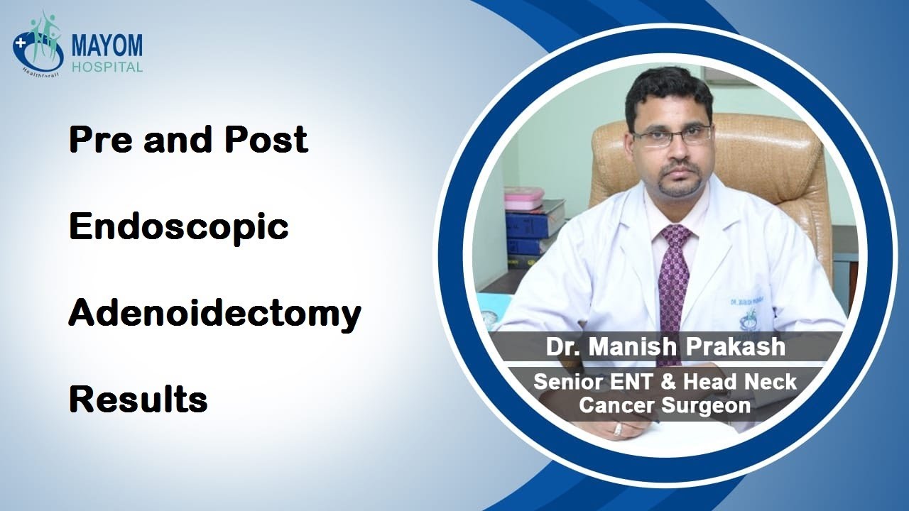 Pre and Post Endoscopic Adenoidectomy results - YouTube