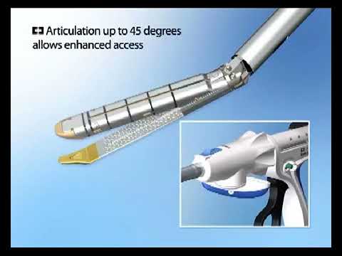 Endo GIA™ Curved Tip Reloads with Tri Staple™ Technology YouTube - YouTube