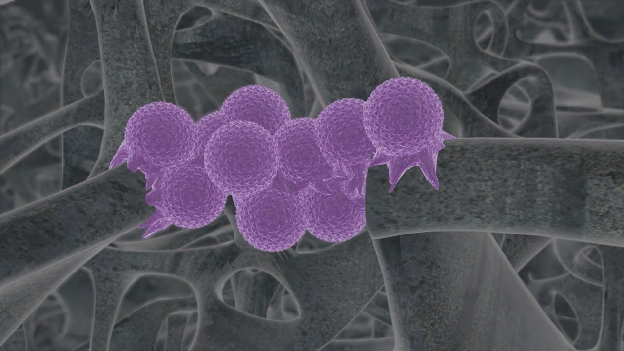 Tritanium In-Growth Technology - YouTube