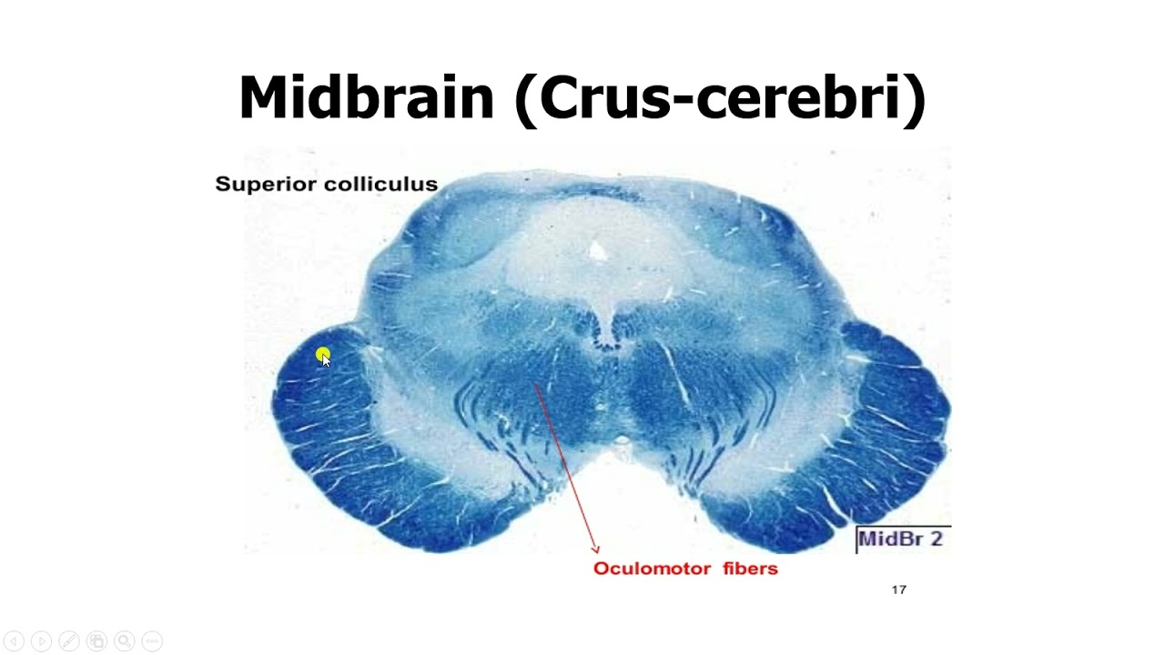 Brainstem Histology - YouTube