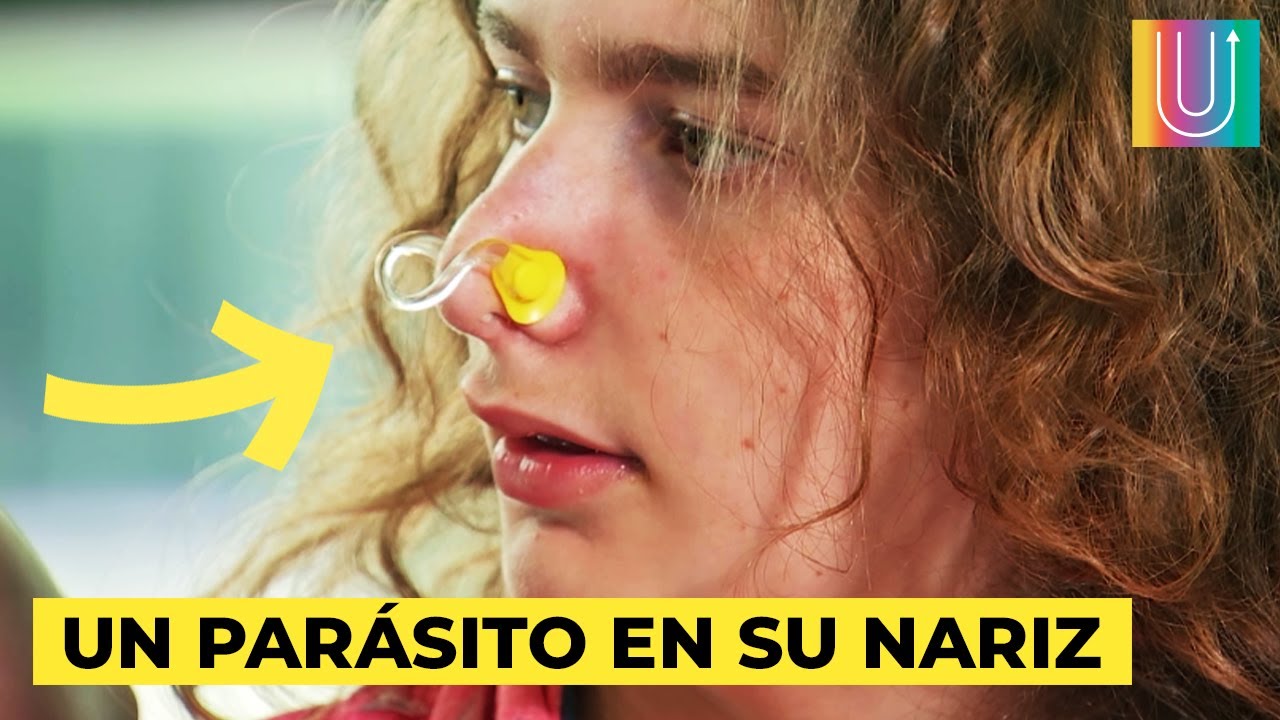 El parásito le entró por la nariz - YouTube