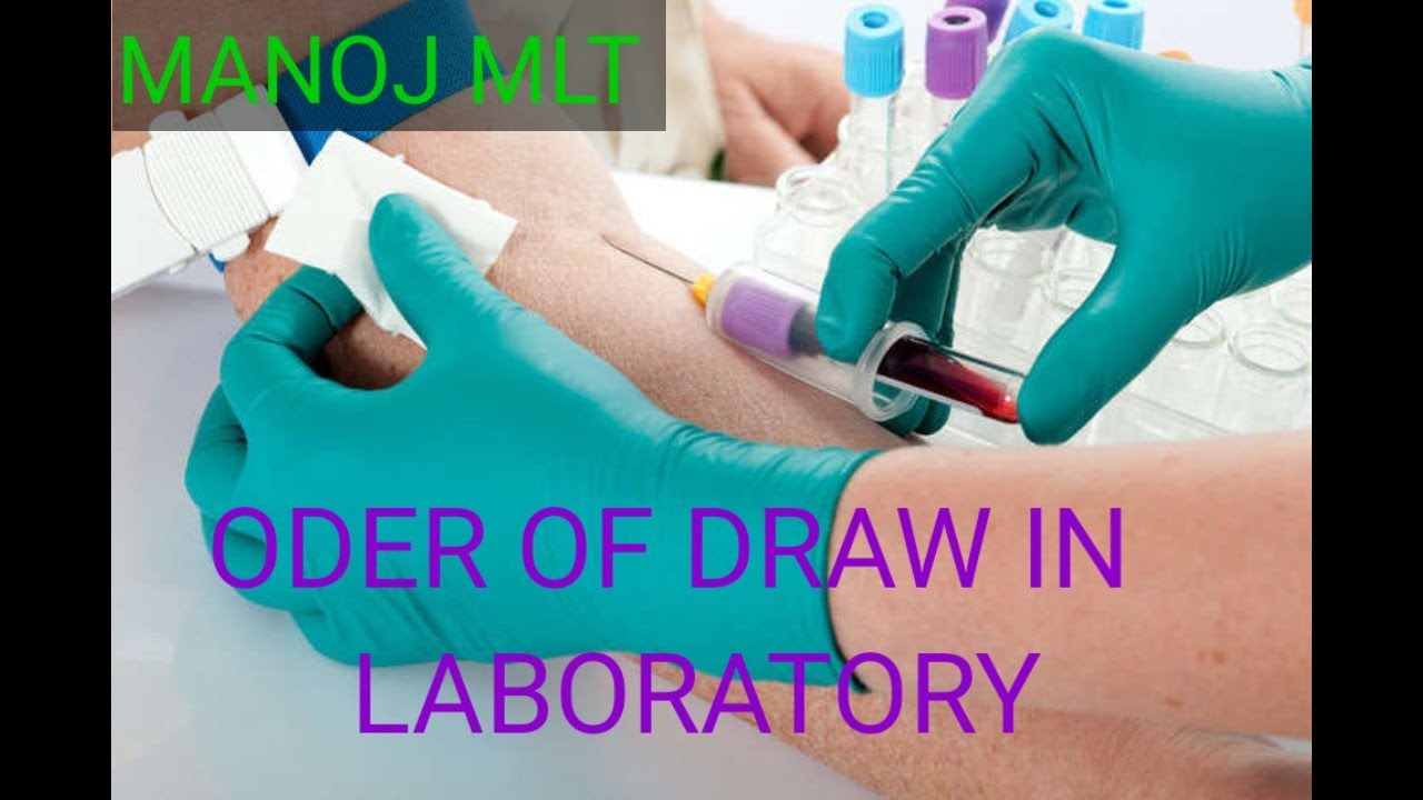 Order of draw / blood collection tune order of draw / lab technologist ...